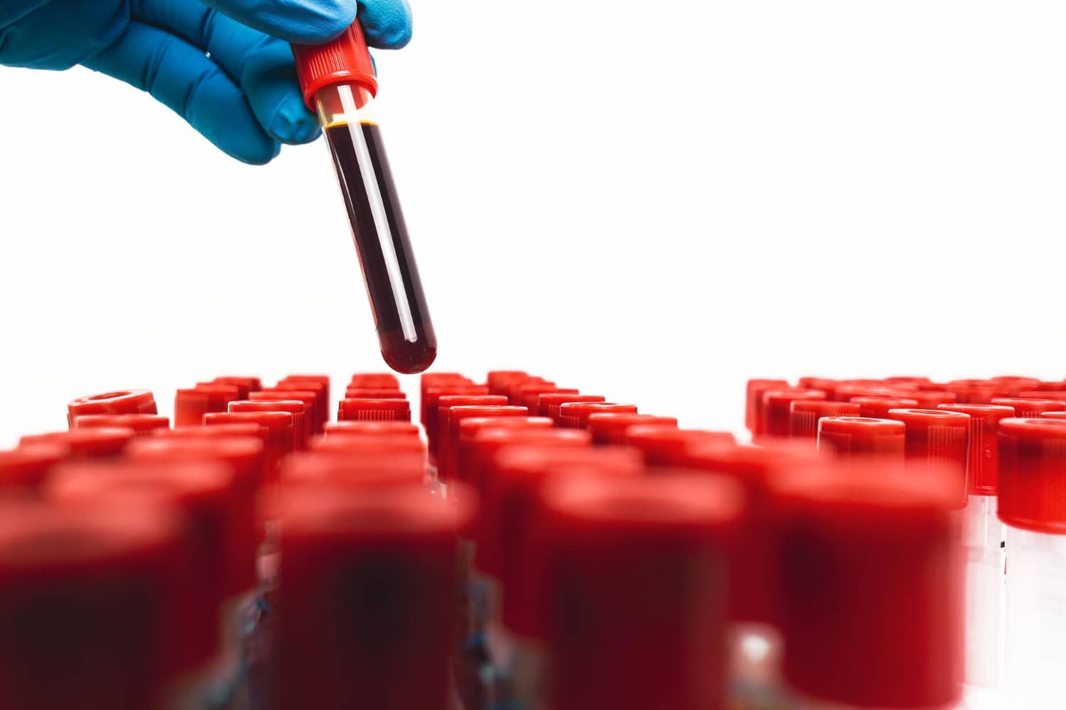 Clinical Value - Efficacy analysis of combined detection of 5 ...